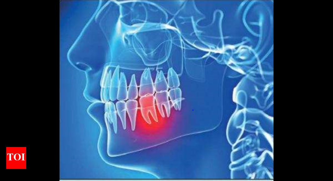 Lucknow: Tooth bone decay? Now, get it reconstructed with own cells at ...