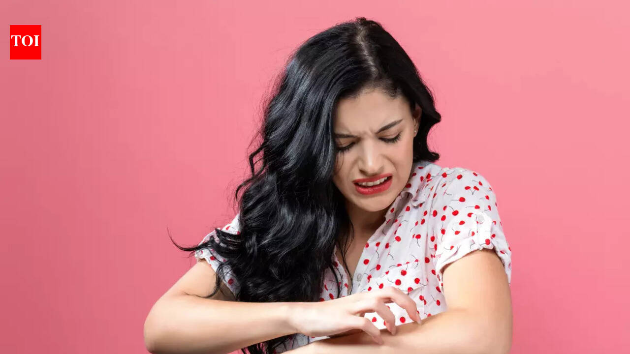 Coronavirus Symptoms on Skin: 5 types of rashes that can be a symptom ...