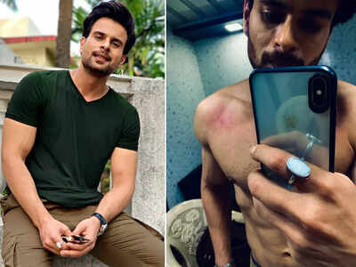Naagin 6 actor Ashish Trivedi gets injured while shooting for a scene ...