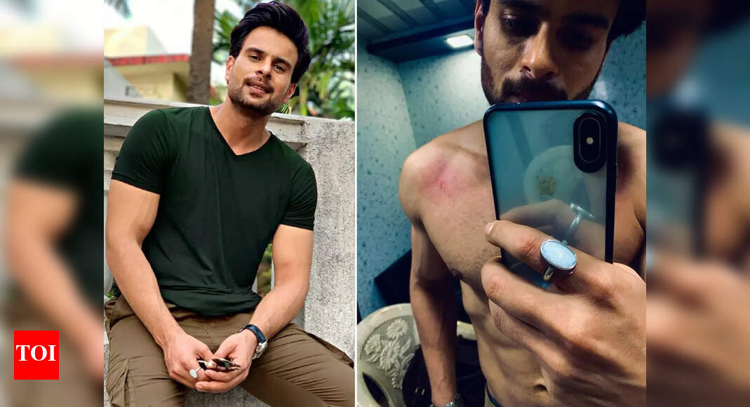 Naagin 6 actor Ashish Trivedi gets injured while shooting for a scene ...