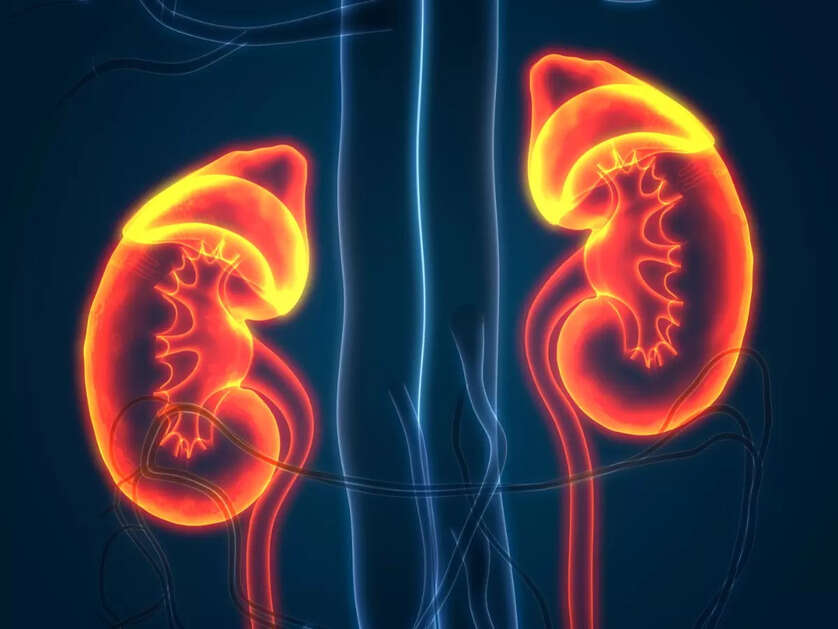 Metastatic Renal Cell Carcinoma And Its Treatment Times Of India