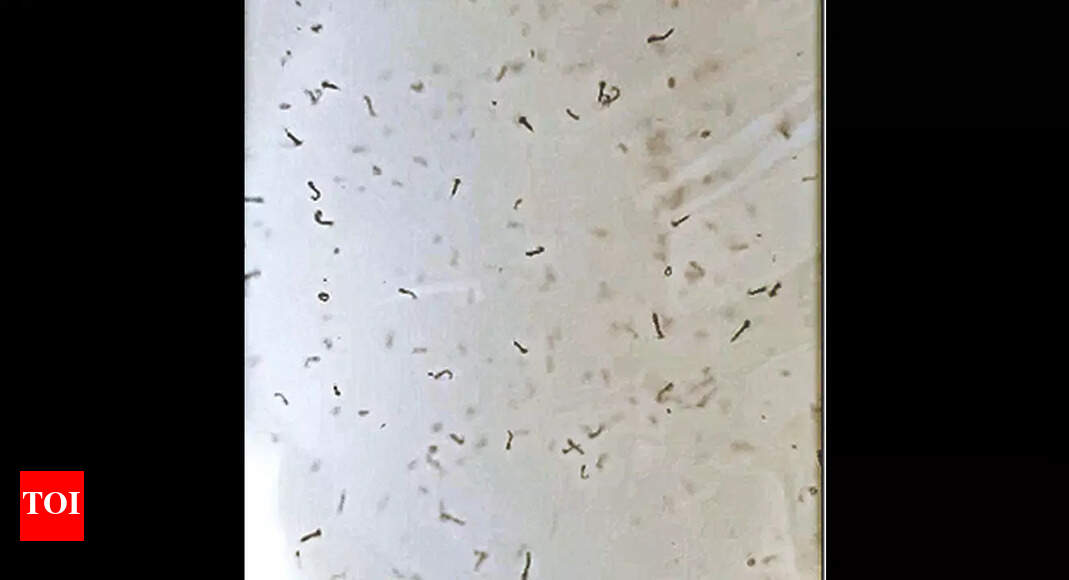 Belagavi: Worms In Water Leave People Sick | Hubballi News - Times of India