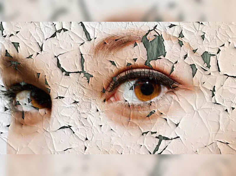 How to repair cracked skin as temperature changes - Times of India