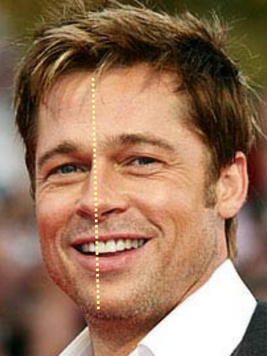 From Golden Blood to double eyelashes, 8 rare body features | Times of ...