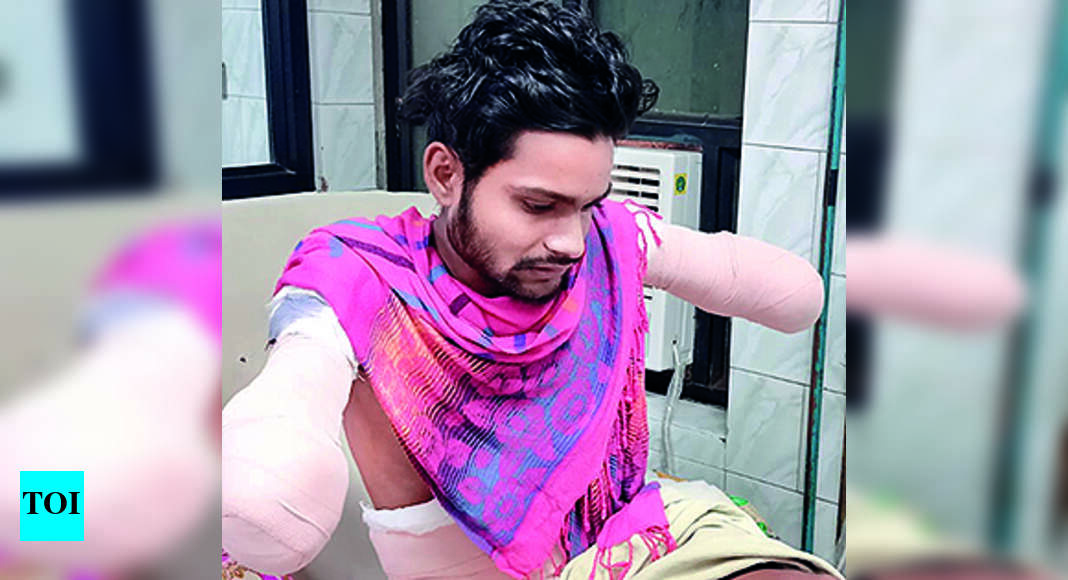 Electrocuted By High Tension Wire, Youth Loses Both Hands | Bhopal News ...