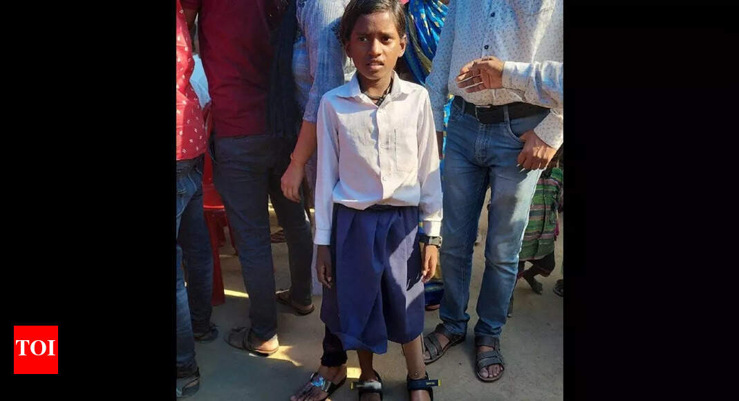 Education Dept Providesartificial Limb To Jamui Girl | Patna News ...