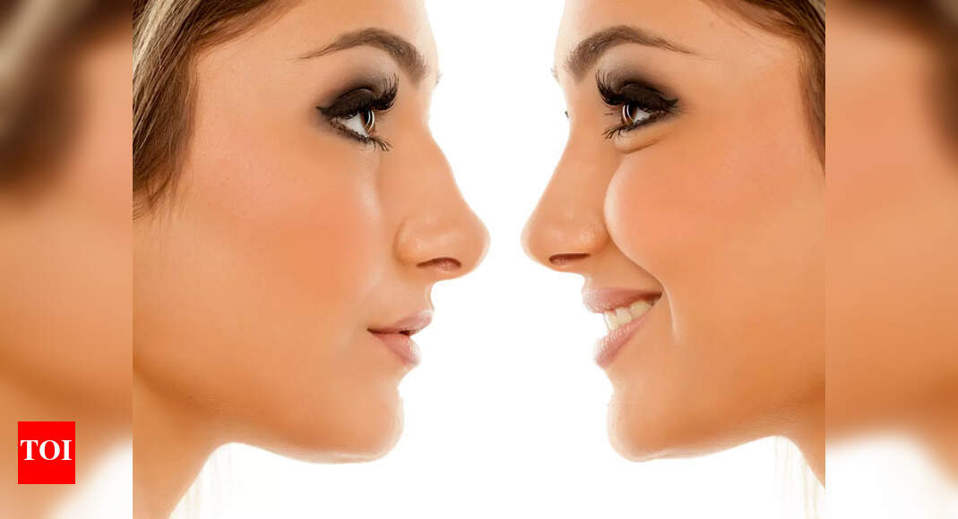 Everything you wanted to know about micro fat grafting - Times of India
