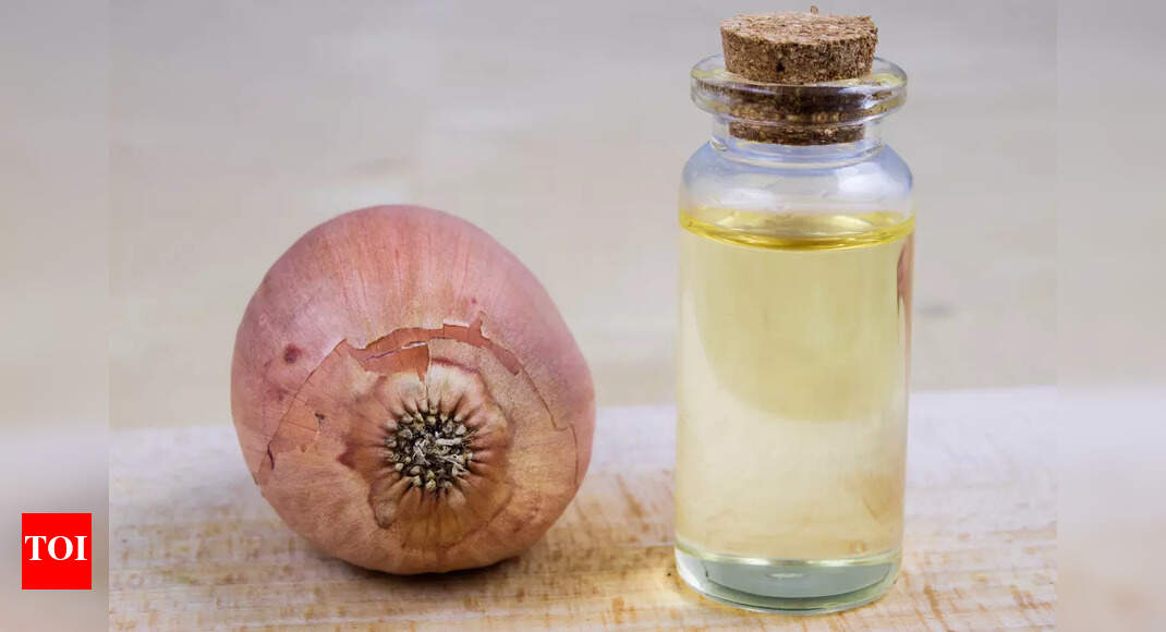 Onion Oil Benefits: All you need to know about using red onion hair oil ...