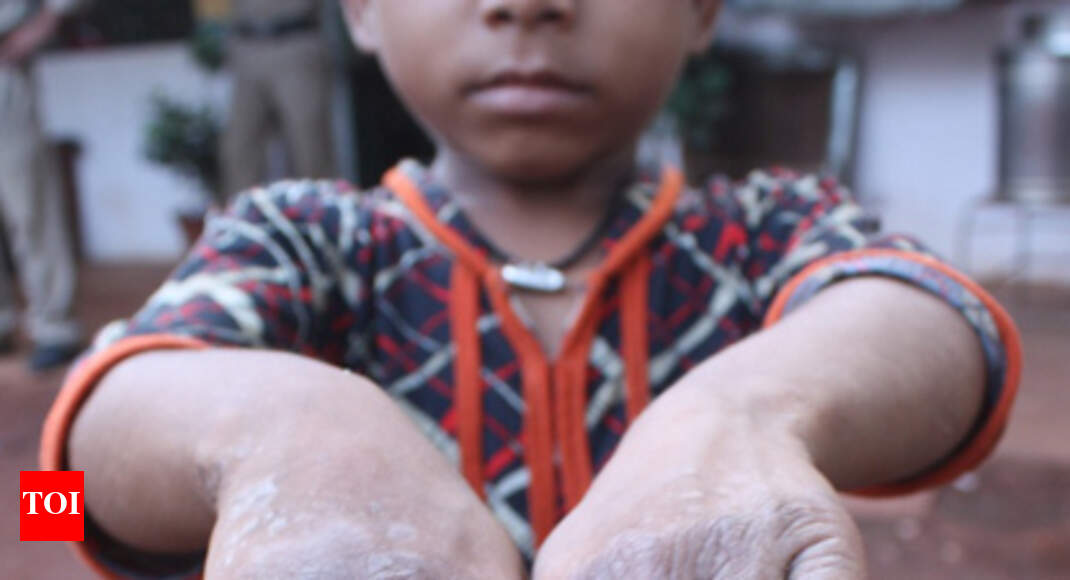 7-year-old escapes a life of misery in a middle class home | India News ...