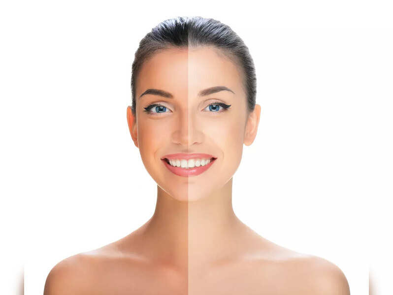 5 Ultimate DIY hacks to de-tan your skin - Times of India