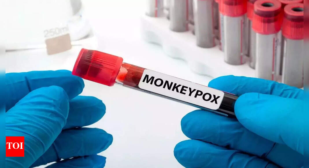 Monkeypox: Monkeypox Virus In Indian Patient Is Milder West African ...