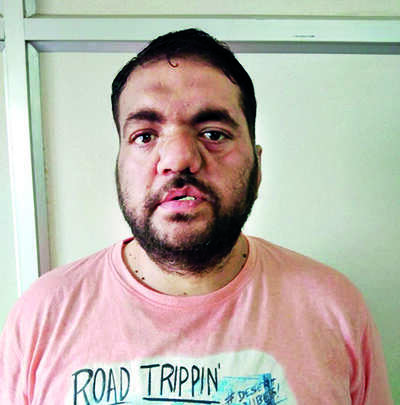 ‘notorious Bootlegger Hiding In Dubai’ | Surat News - Times of India