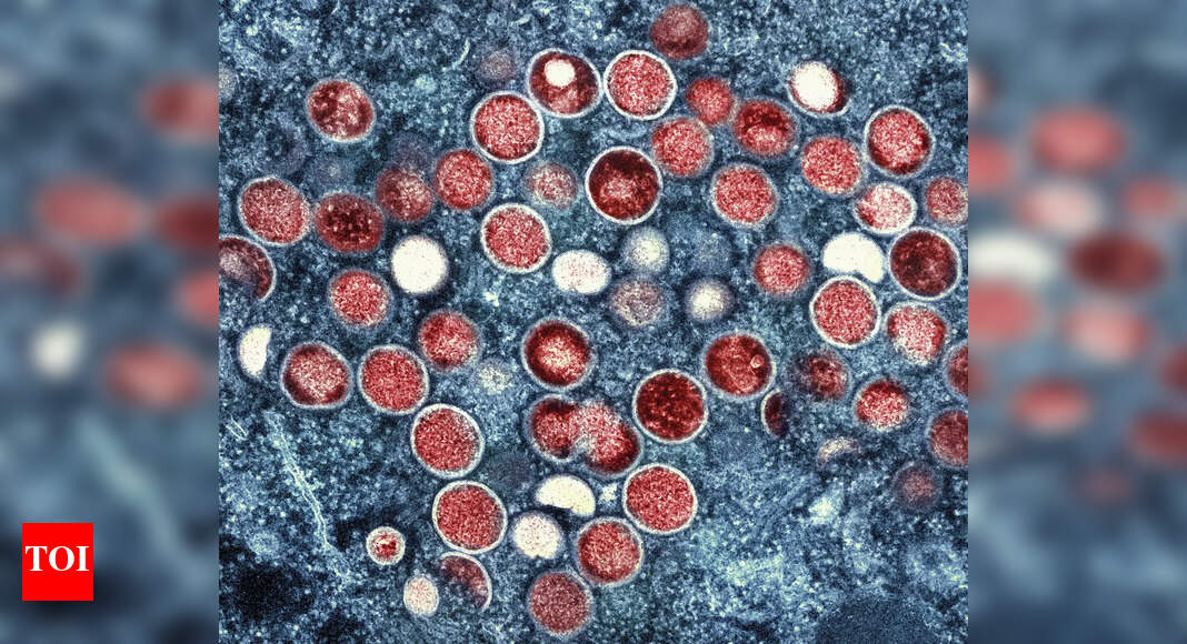 WHO turns to public for monkeypox name change - Times of India