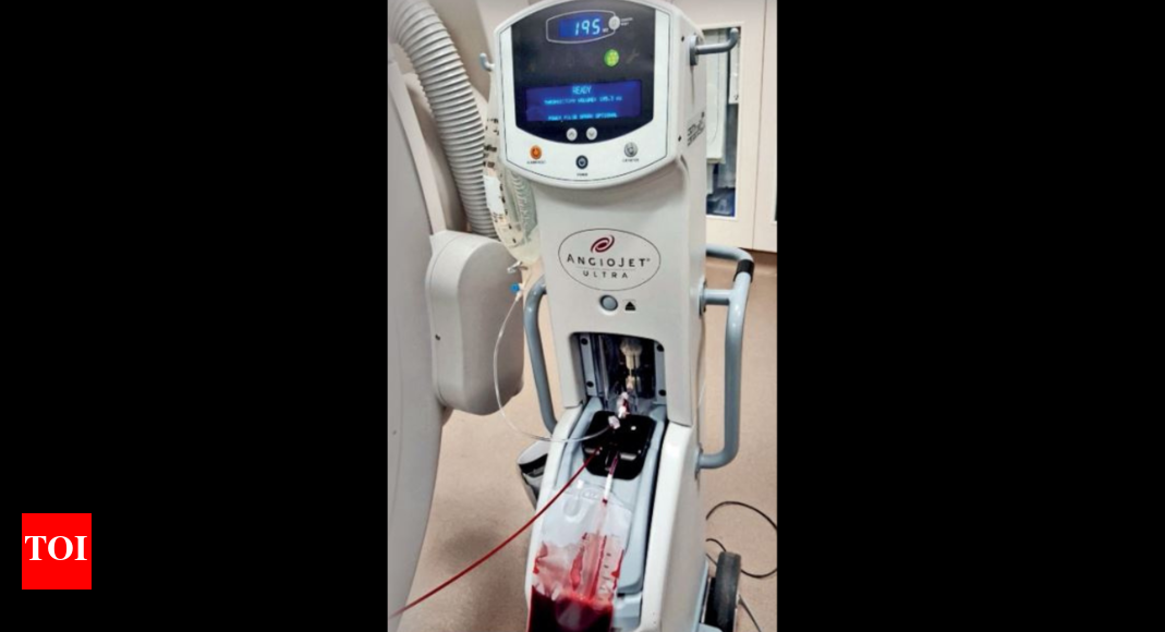 ‘angio-jet’ Helps Pulmonary Blockage Patients Breathe Easy | Vadodara ...