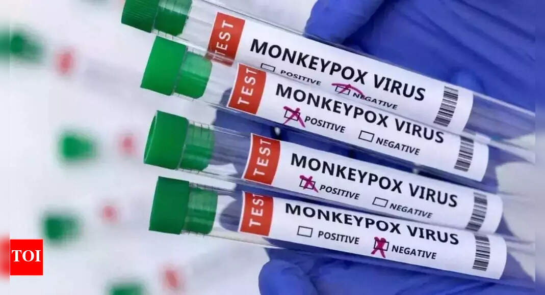 Delhi records 9th monkeypox case; India tally rises to 14 | Delhi News ...