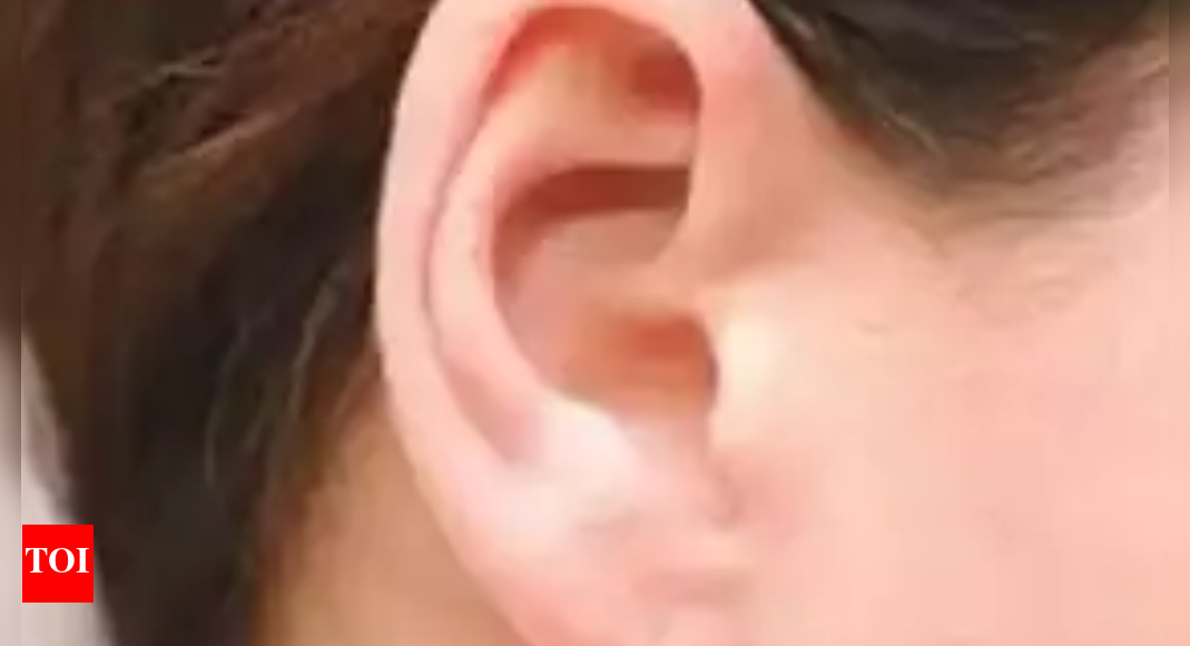 7455 Suffer From Hearing Impairment | Raipur News - Times of India
