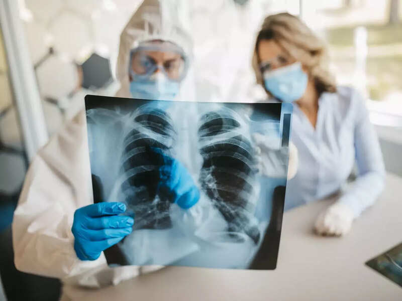 Coronavirus: Researchers detect long COVID’s impact on lungs using ... Coronavirus: Researchers detect long COVID’s impact on lungs using ...