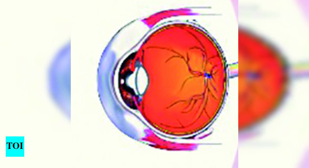 40% Of Conjunctivitis-afflicted Are Kids In Dk, Says Health Department ...