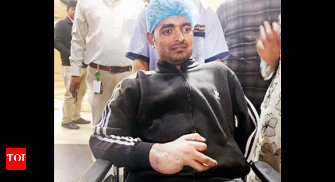 Legs & arm amputated in July, man takes small steps in Delhi | Delhi ...