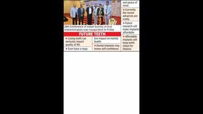New age dental implants promise ‘toothful’ and ‘youthful’ life | Nagpur ...
