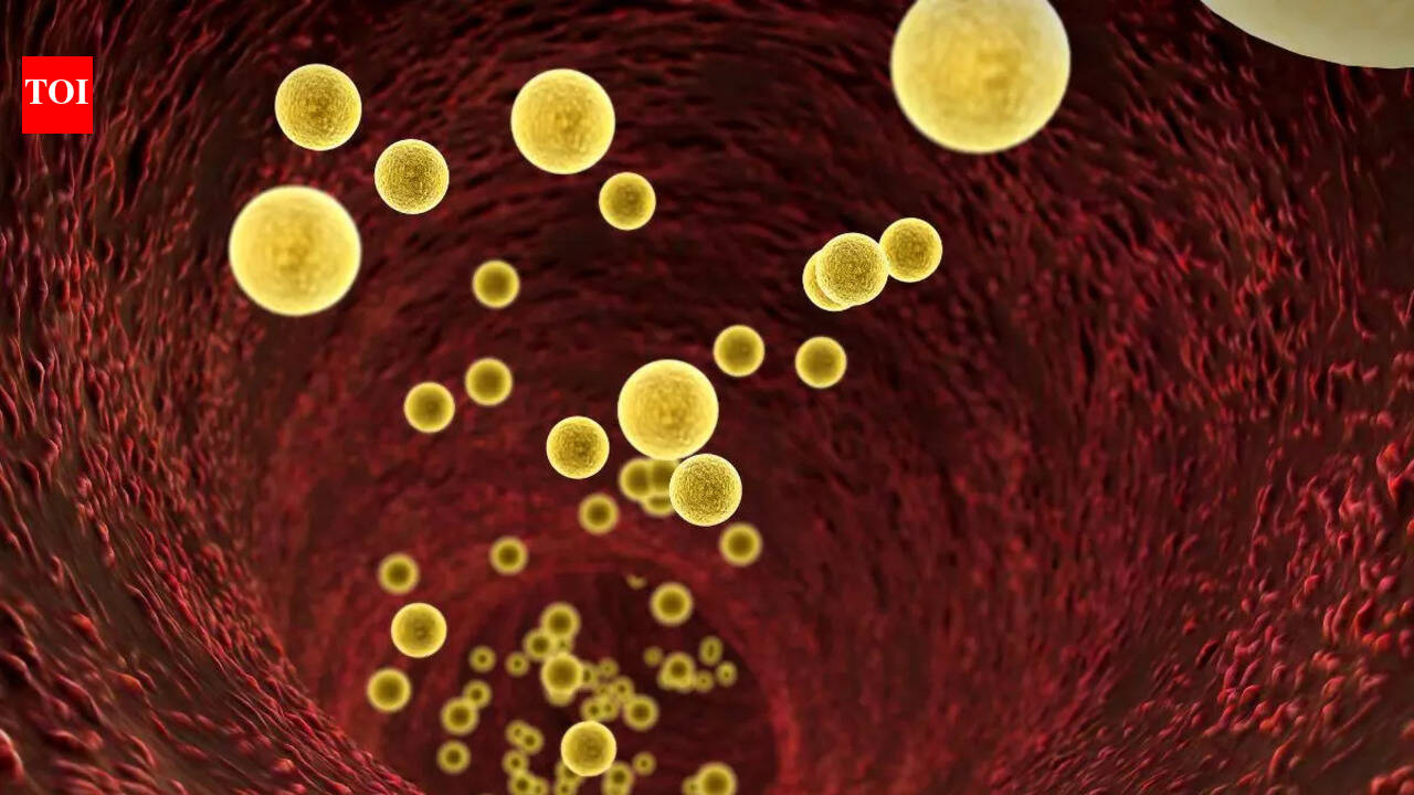 High cholesterol: 4 warning signs of fat buildup in artery walls