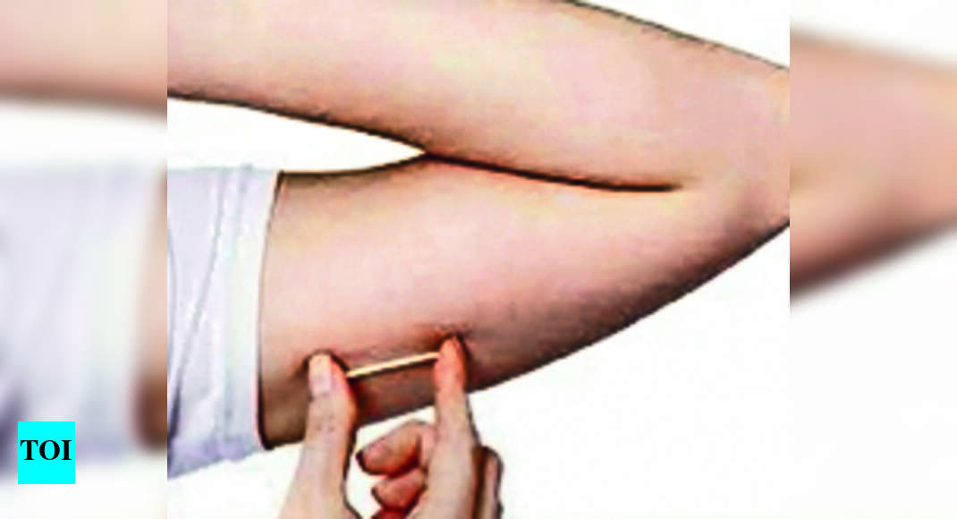 Implanon Nxt: Fpai: New Contraceptive For Women Is More Effective ...