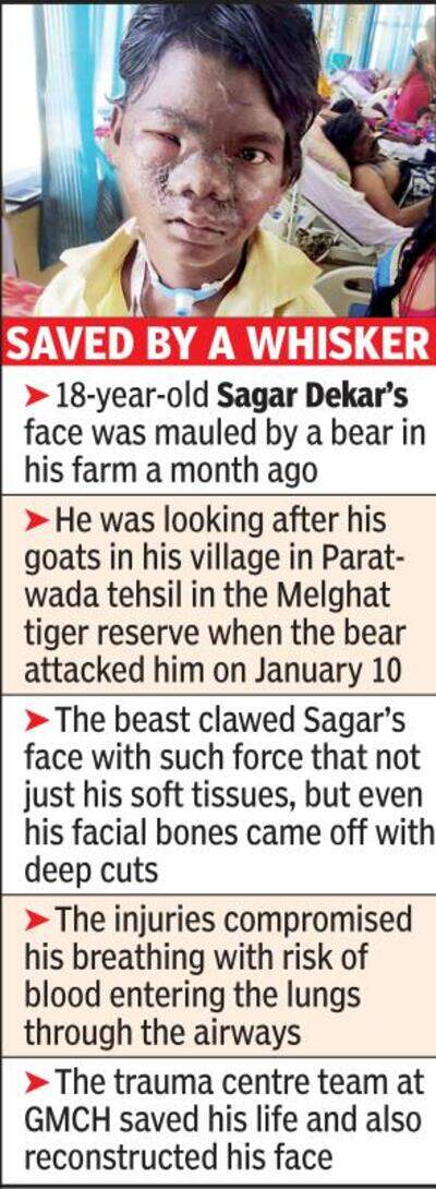 Trauma centre saves 18-yr-old bear attack victim’s life & face | Nagpur ...