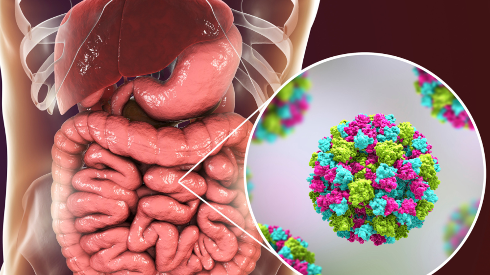 Norovirus cases rise in US and UK; learn about symptoms to spot and how to prevent it | The ...