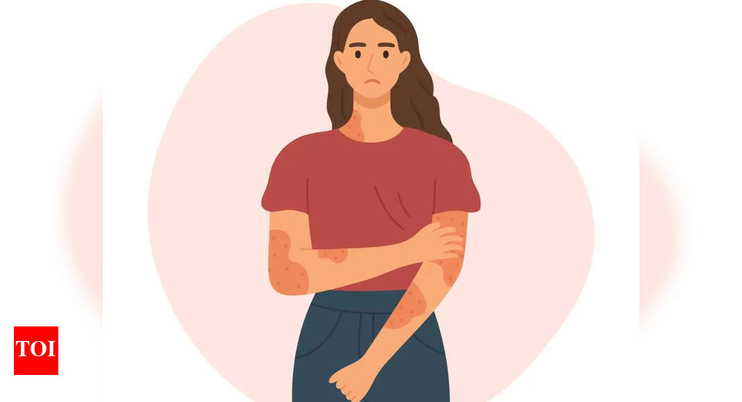 Shingles Awareness Week 2023: What you need to know about this painful ...