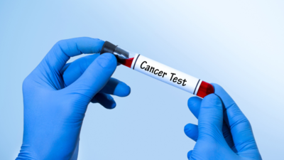 Weekly cancer testing at 40 medical colleges in Maharashtra | Mumbai ...