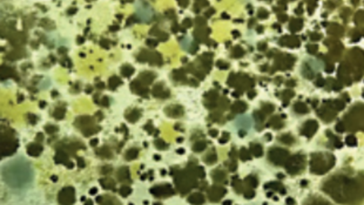 Plant fungus infects researcher in Kolkata, likely to be first human ...