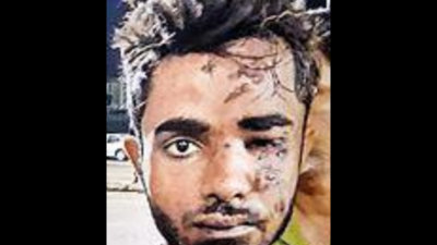 Kozhikode train arson case: Cops unsure whether Shahrukh Saifi received help from others ...