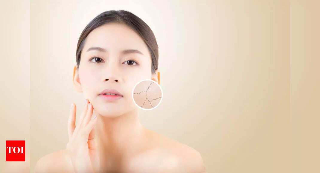 Reasons for dry skin and the perfect home remedies to soothe it - Times ...
