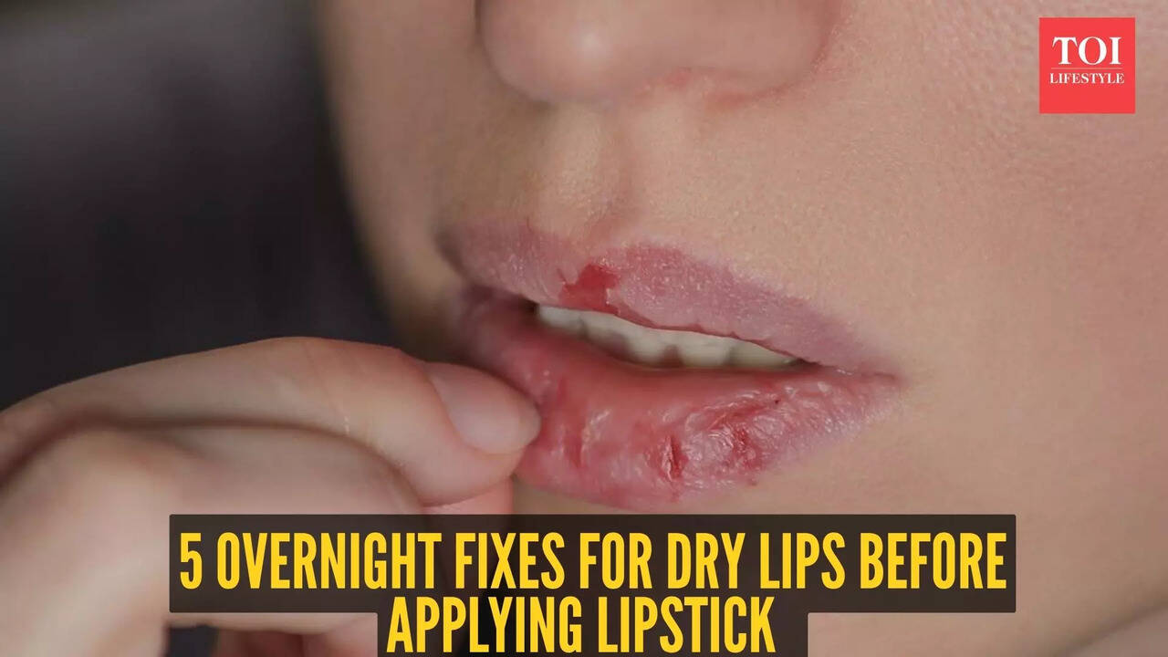 Why Are My Lips Always Dry At Night - Infoupdate.org